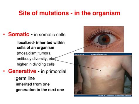 Ppt Genetics Mutation And Polymorphism For Ed Students Powerpoint