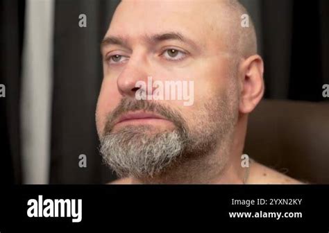 Bald Man Scratching Gray Beard Hairless Male Itching Gray Beard Bald