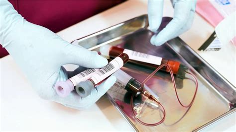 Western Blot Test Uses Accuracy Procedure Cost And More