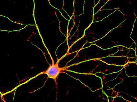 Real Neuron Cell