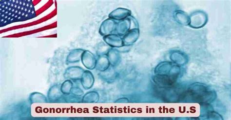 Gonorrhea Statistics In Us 2025 Facts About Gonorrhea The Global
