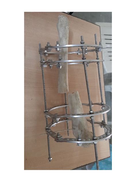 Ortho Instruments Pdf