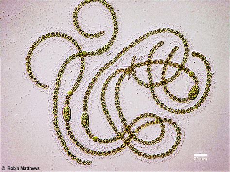 Cyanobacteria Nostocales Aphanizomenonaceae Dolichospermum Circinale Dolichospermum 557 