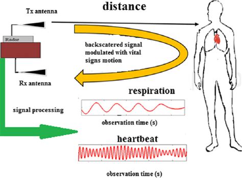Measurement Schematic Of Vital Sign Motion Tracking By Uwb Soundings