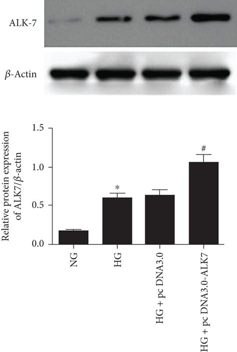 Alk7 Enhances Hg Induced Production Of Ros Inflammatory Cytokines And