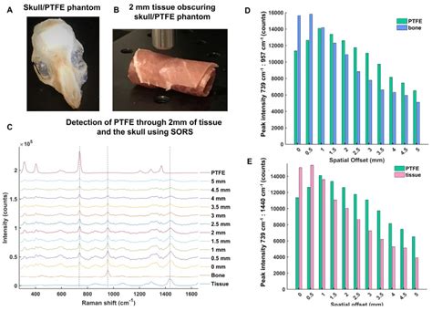 Non Invasive In Vivo Imaging Of Cancer Using Surface Enhanced Spatially