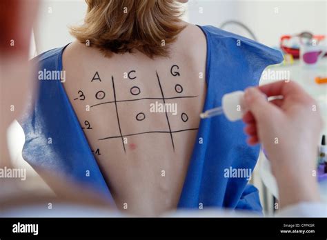 Allergy Test Woman Stock Photo Alamy