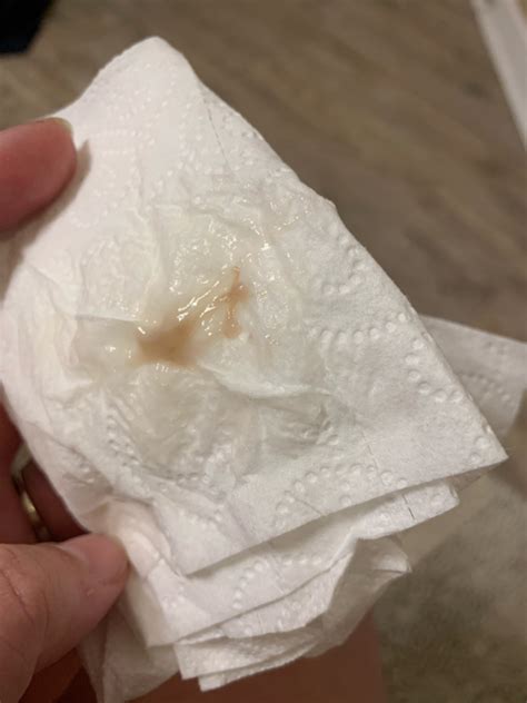 Implantation Bleeding Glow Community