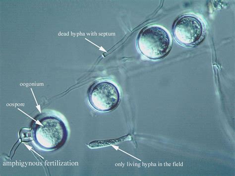 Oosporo 7 Nowakowskiella Elegans Zoosporângios Operculados 8