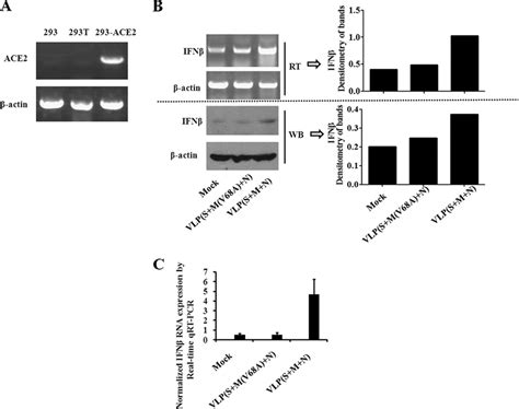 M Protein Derived From Sars Cov Pseudoviruses Or Virus Like Particles