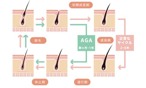 【医師監修】毛周期（ヘアサイクル）とは？AGAとの関係について|【公式】薄毛・抜け毛治療ならAGAスキンクリニック（Aスキ）