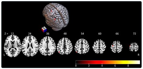 The Neural Bases Of Egocentric Spatial Representation For Extracorporeal And Corporeal Tasks An