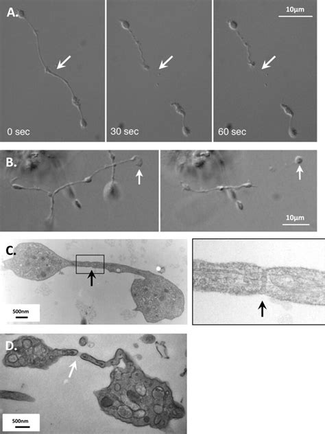 Direct Visualization Of Proplateletplatelet Release In Culture A And