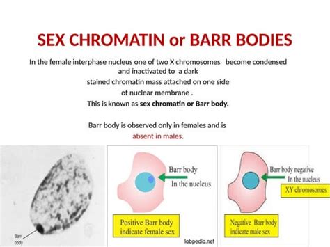 Sex Linked Inheritance Ppt
