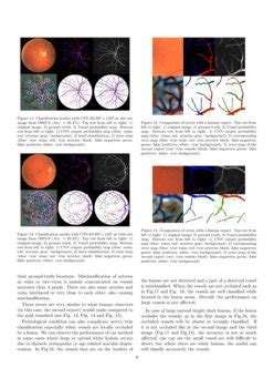 Joint Segmentation And Classification Of Retinal Arteries Veins From Fundus Images DeepAI