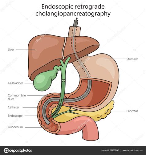 endoscopic retrograde cholangiopancreatography structure vertebral