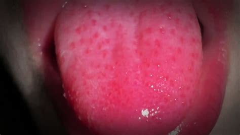 Asmr Nana困薯 Restudio 舌頭展示 口腔检查 Eporner