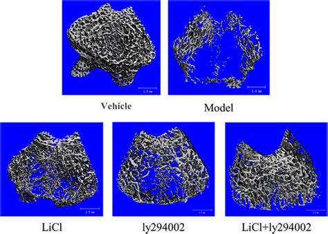 Effects Of Licl Ly294002 And Licl Ly294002 On The Femoral