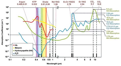 High Precision Laser Therapy Transforms Dentistry Features Sep 2018