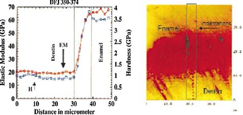 Elastic Modulus Distribution In Natural Dentino Enamel Junction From Download Scientific
