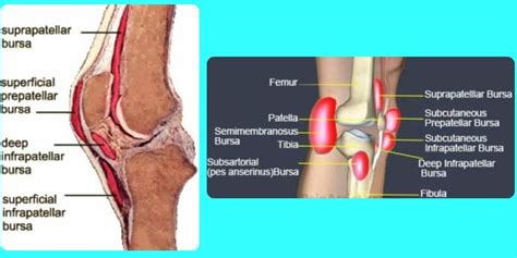 Bursitis Knee Treatment Pictures Symptomscauses Diagnosis