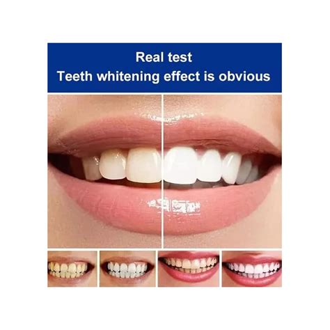 3pcs Yayashi Sp 4 Toothpaste Toothpaste Fresh Ubuy India