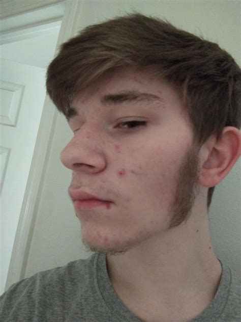 Im 16 Years Old And Currently Trying To Grow A Full Beard Any Tips