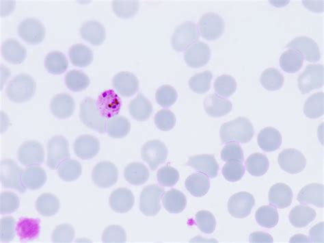 Malaria Detection Object Detection Model By Universiti Malaya