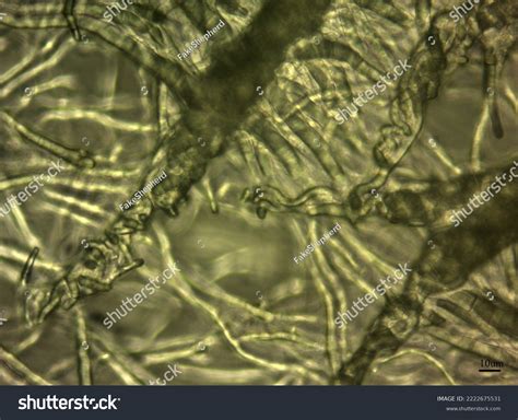 Trichoderma Vs Fusarium Dual Culture Pda Stock Illustration 2222675531 Shutterstock