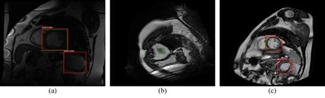 Examples Of False Or Missed Detection In The Proposed Method Where