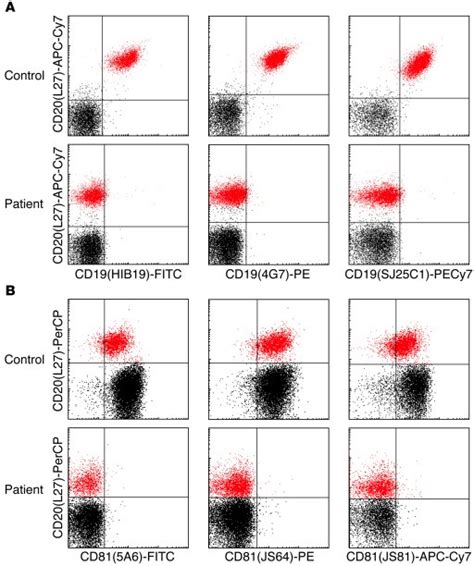 Jci Cd81 Gene Defect In Humans Disrupts Cd19 Complex Formation And