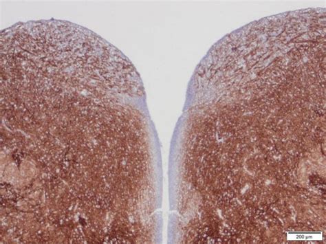 Sequences Of Synaptogenesis In The Human Fetal And Neonatal Brain By Synaptophysin