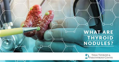 Thyroid Surgery Austin What Are Thyroid Nodules