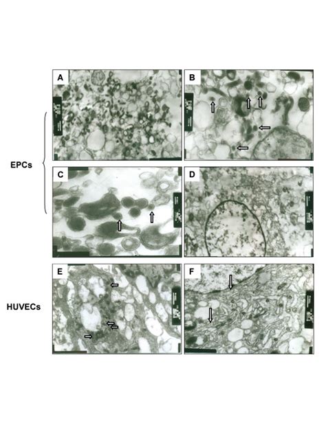 Detection Of Hbv Viral Particles In Epcs Hbv Treated A B And C Or