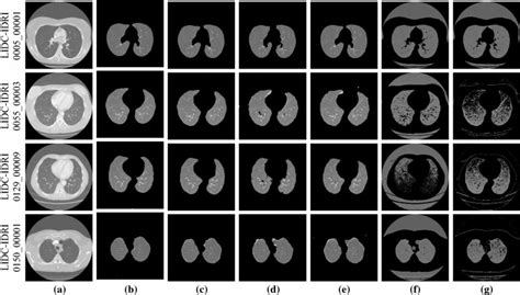 visual results of different lung segmentation methods on lidc idri