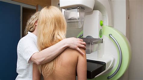 New Nccn Guidelines For Mammography All Women Over 40 Frank Herd