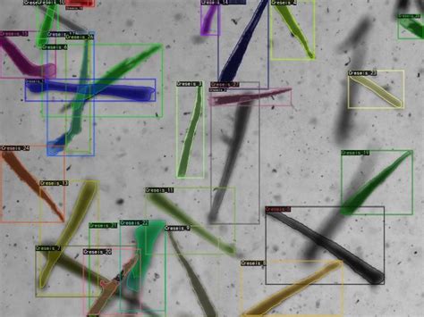 A Plankton Image Dominated By Creseis Acicula To Illustrate The