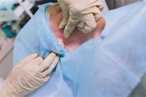 Premium Photo Aged Woman Doing Mesothreads And Thread Lifting