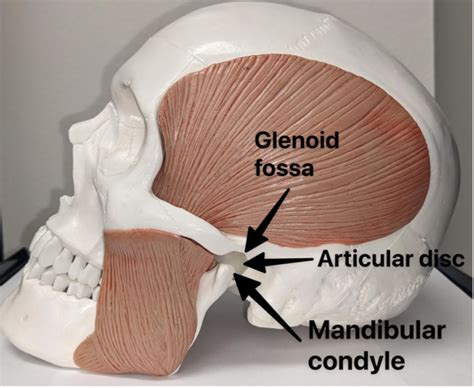 Mandibular Condyle Reverse Angle Of The Affected Side Retroflexed
