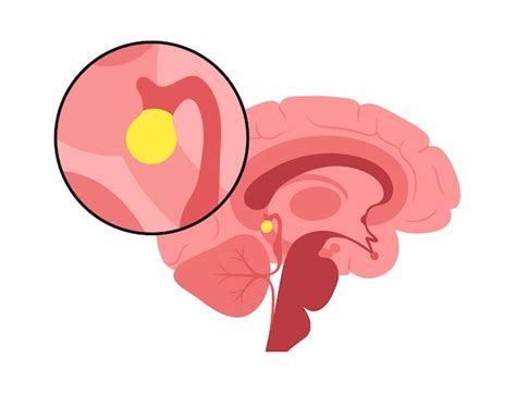 Premium Vector Pineal Gland Anatomy
