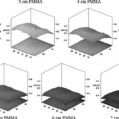 Cnr Images Obtained With The Ge Essential Cnr Values Are Normalized To