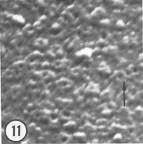 Figure 11 From Nuclear Surface Complex As Observed With The High