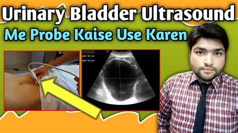 Mastering Urinary Bladder Ultrasound A Step By Step Guide To Probe Orientation Youtube