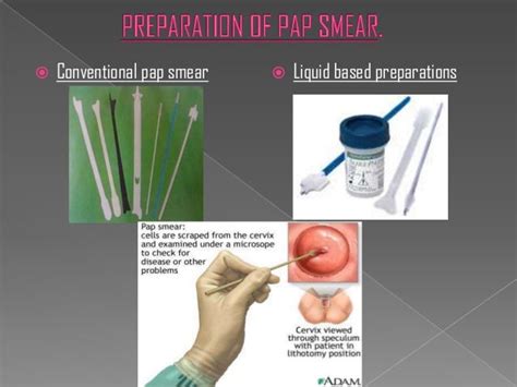 Pap Smear