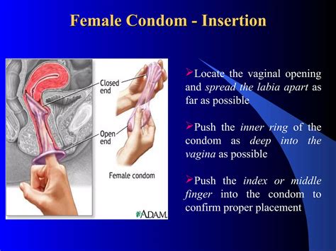 The Female Condom Ppt