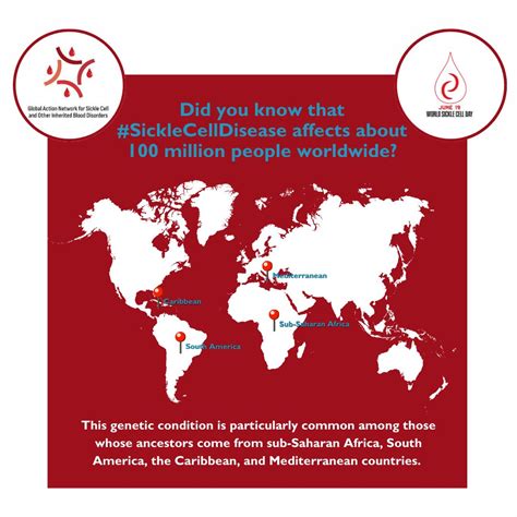 Ayoola Olajide On Linkedin Didyouknow Sicklecelldisease