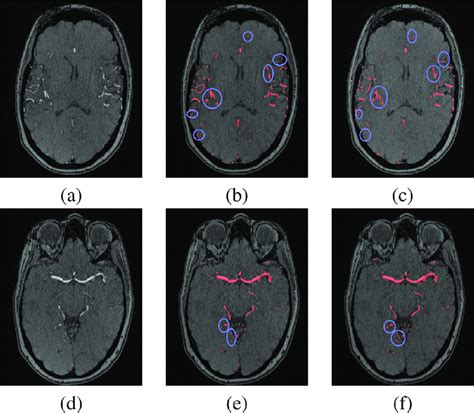 A 2 D Segmentation Output Of Global And Local Experiments At Two