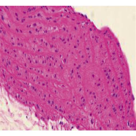 Hande Staining Results Of Rat Aorta In The Administration Group ×400 Download Scientific