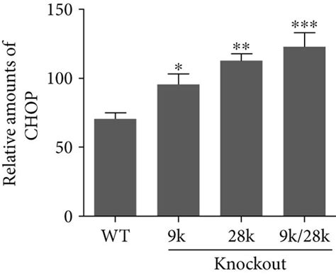 Expression Of Bipgrp78 And Chop Proteins In The Brains Of Cabp 9k