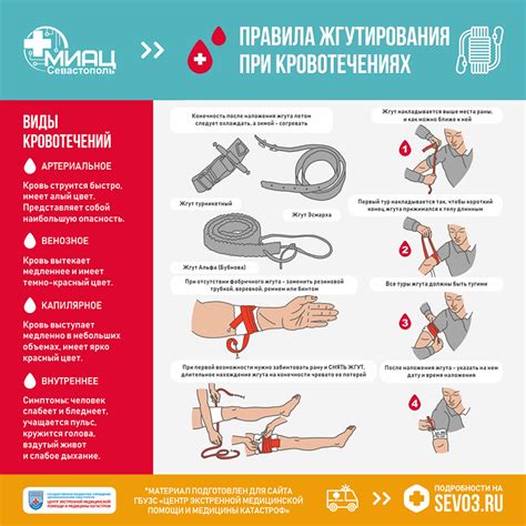 Методы временной остановки кровотечения при оказании первой помощи
